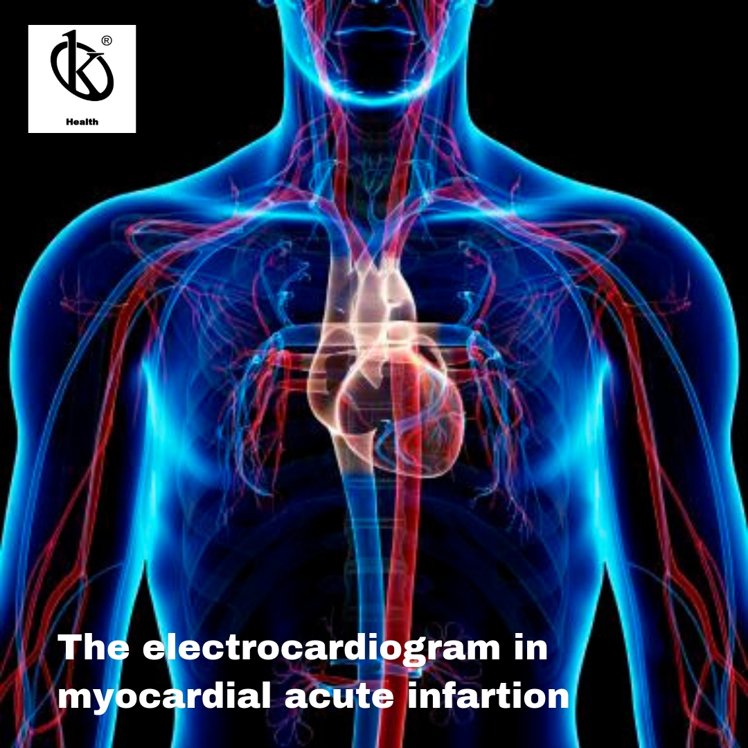 The electrocardiogram in myocardial acute infartion - Kalstein France
