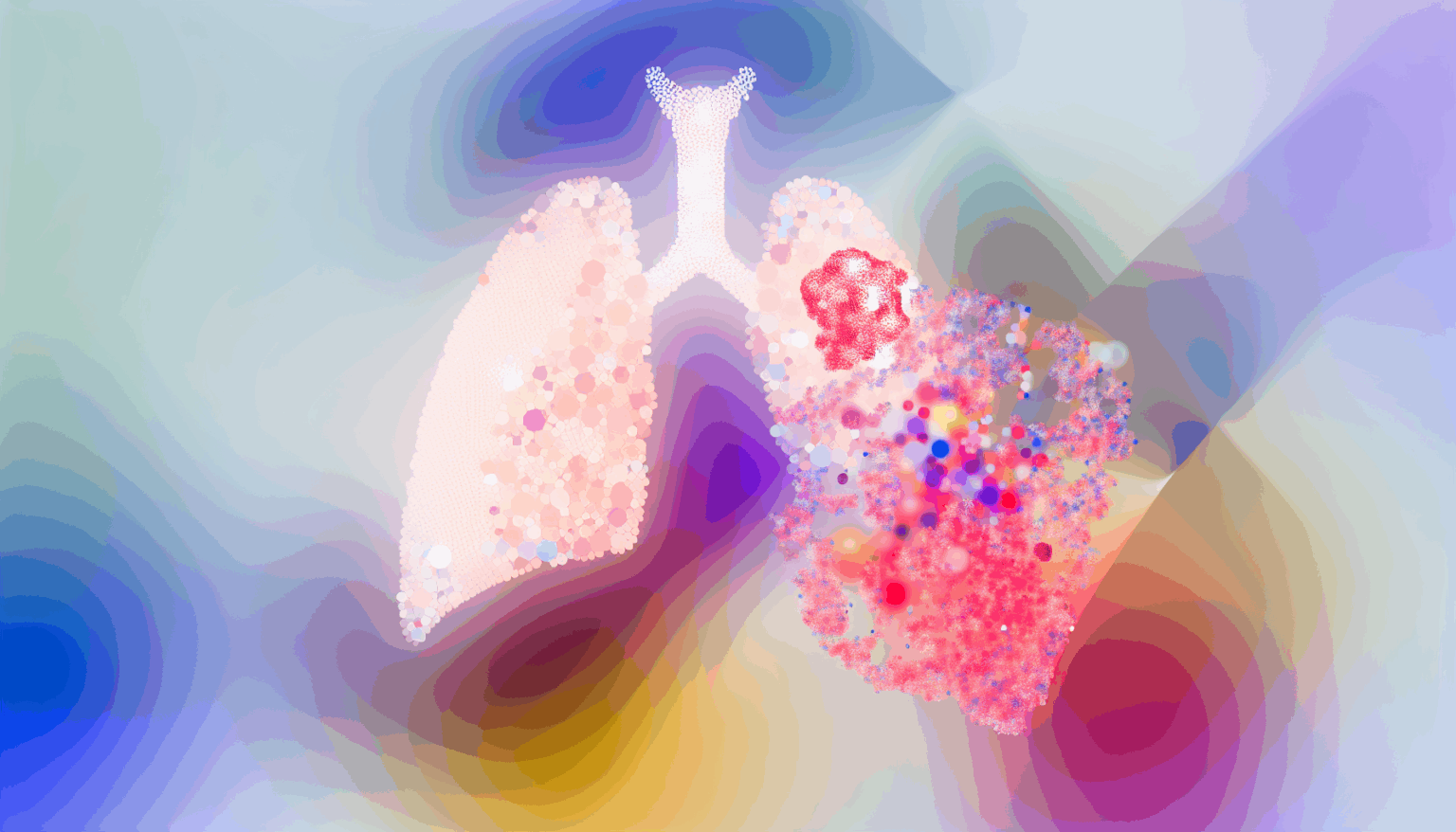The Role of Bronchoalveolar Lavage Fluid Metagenomics in Diagnosing and ...